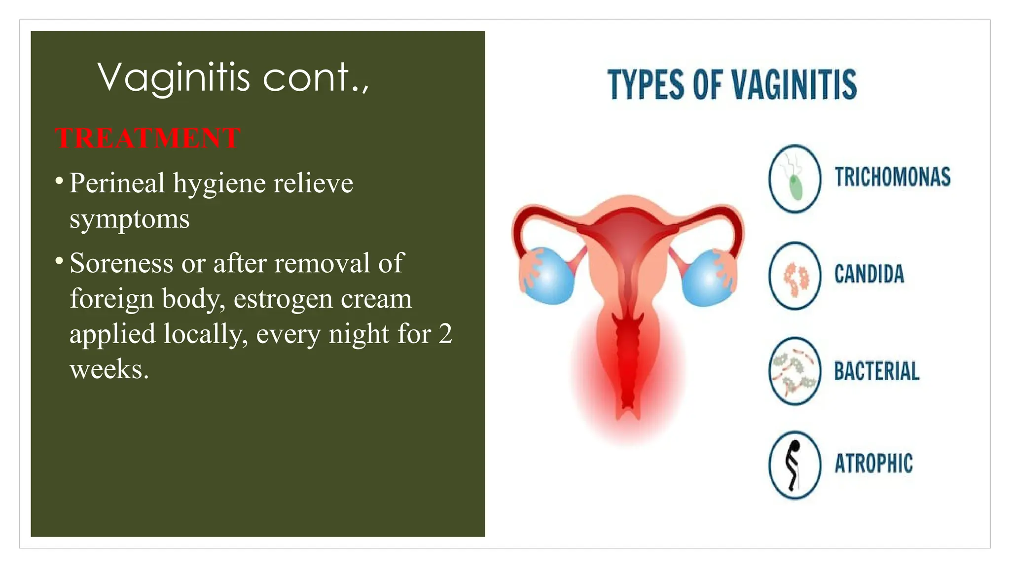 GENITAL TRACT INFECTIONS obstetrics and gynaecological nursing | PPTX