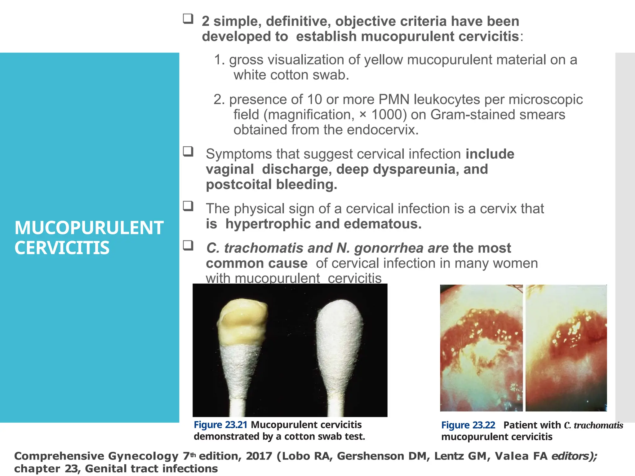 genital tract infections with UTI and PID.pptx
