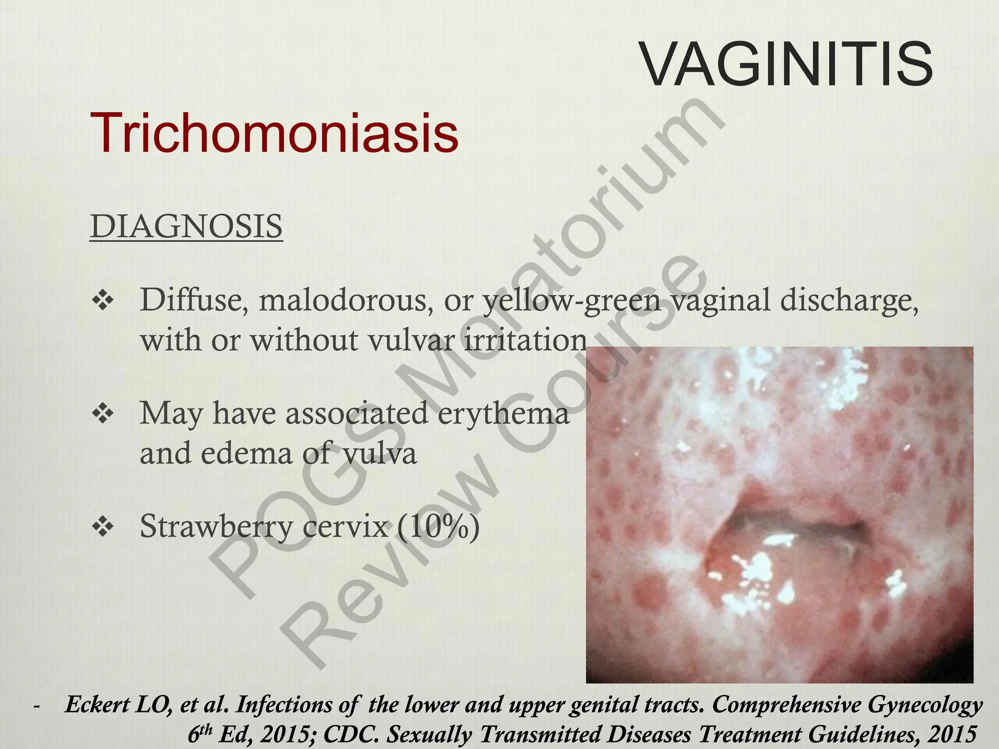 Genital Tract Infections of upper and lower reproductive organ | PPT