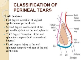 GENITAL TRACT INJURIES.pptx