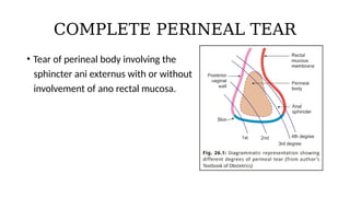 GENITAL TRACT INJURIES detailed discussion | PPTX