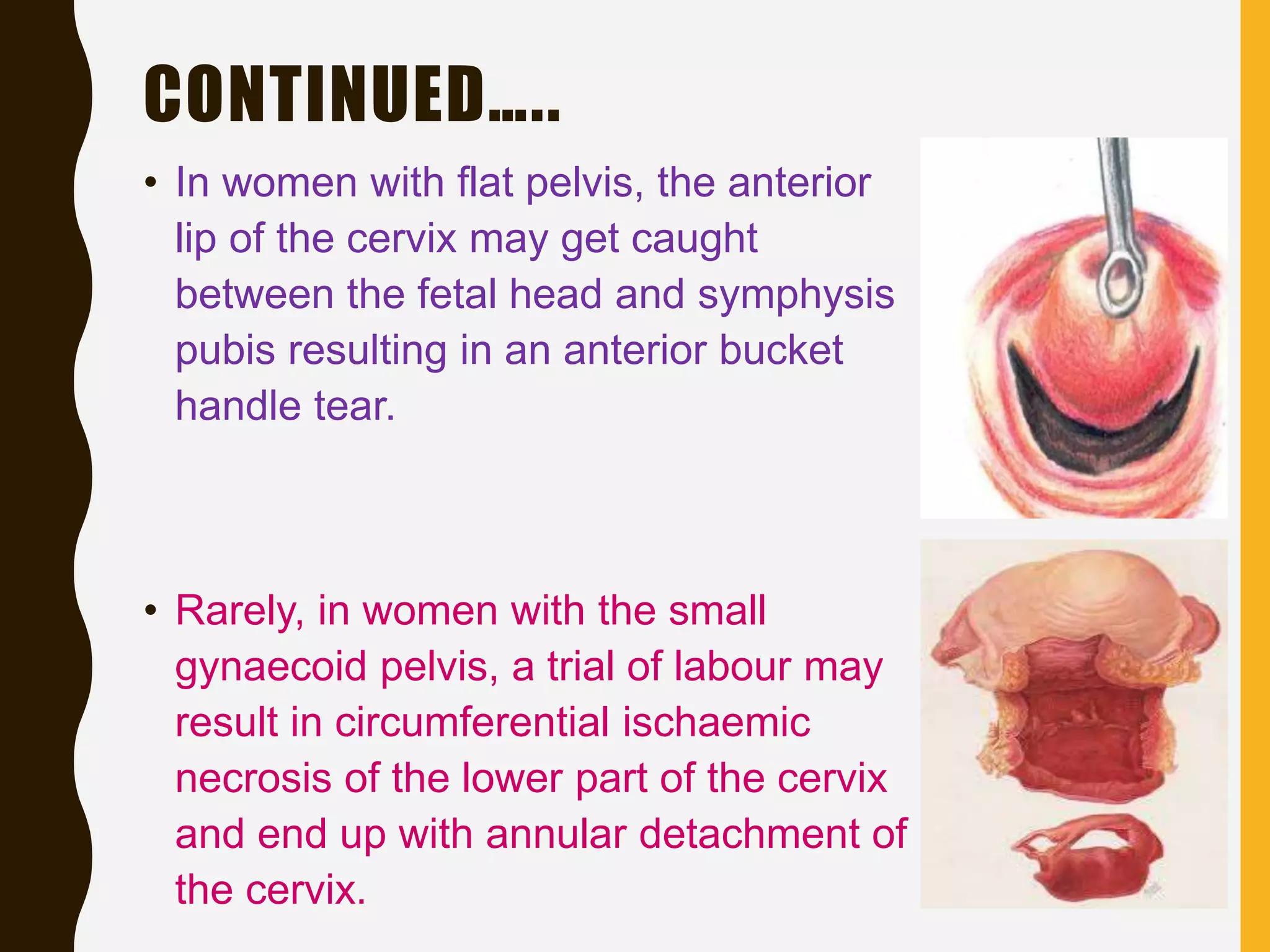 Genital tract injuries1 | PPTX