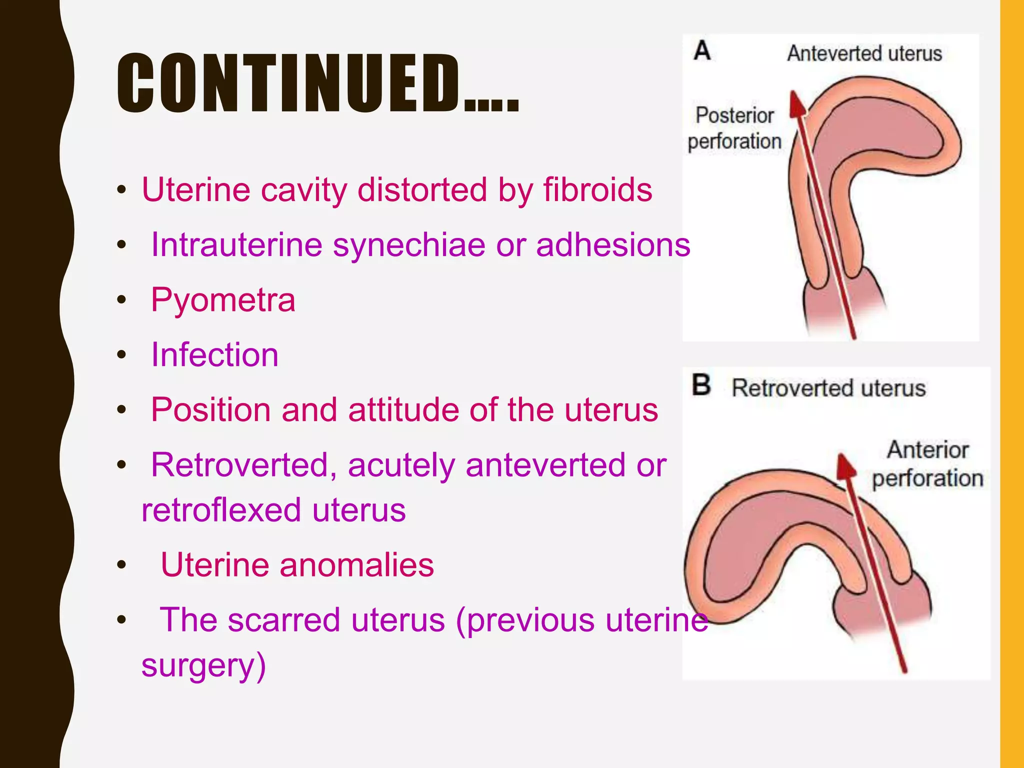 Genital tract injuries1 | PPTX