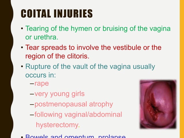 Genital tract injuries1 | PPTX