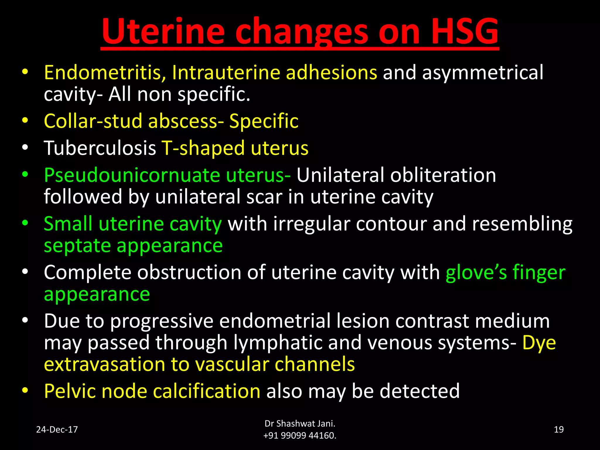 GENITAL TUBERCULOSIS - HOW TO DIAGNOSE & WHEN TO TREAT BY DR SHASHWAT ...
