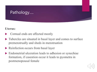 Genital tuberculosis | PPTX