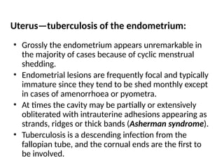 Genital tuberculosis final.pptx ggfffffff | PPT