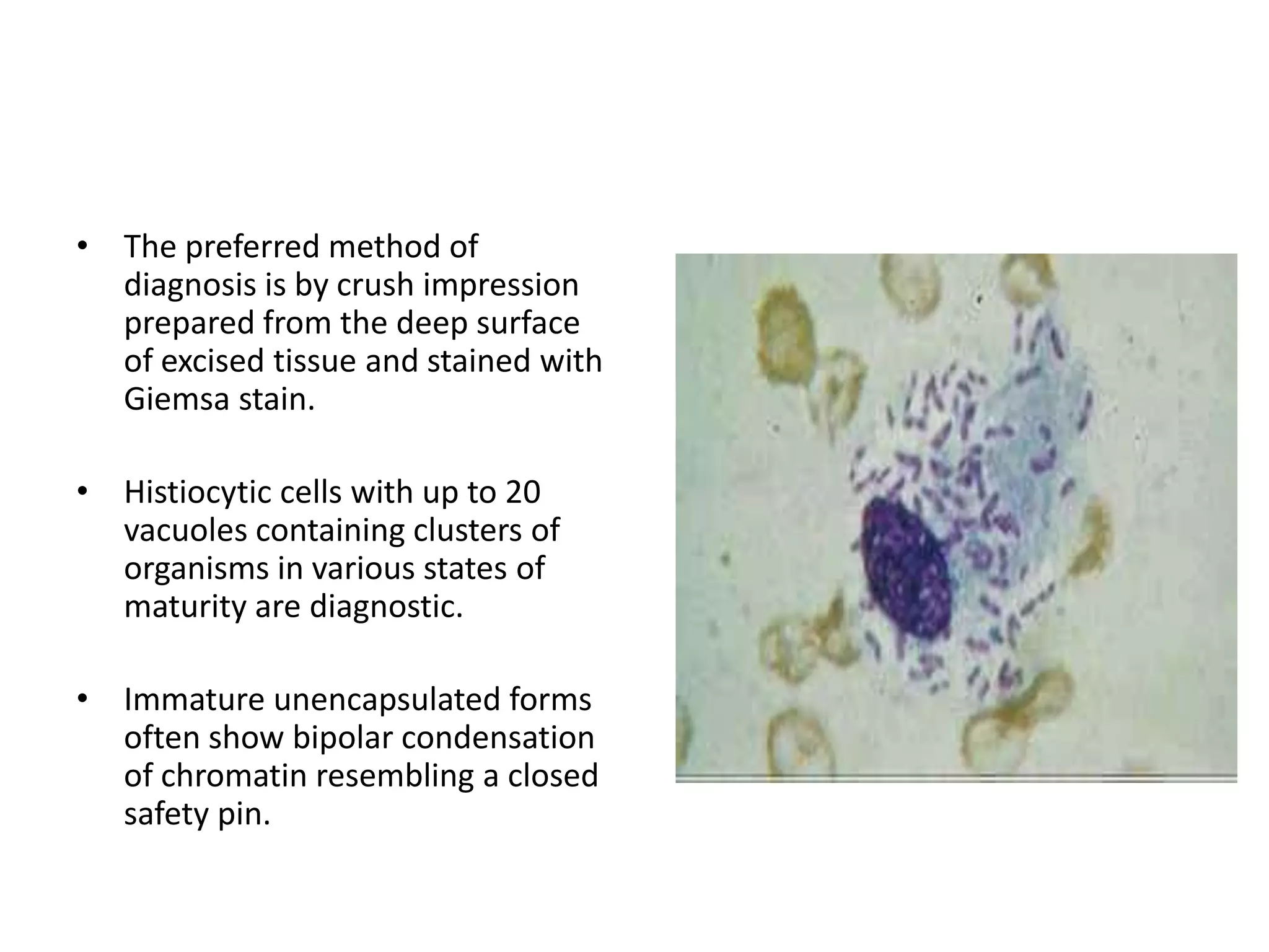 Genital ulcer | PPTX
