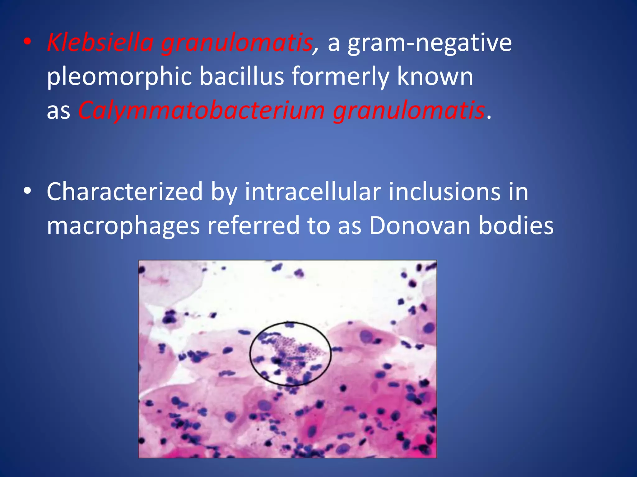 Genital ulcer disease | PPTX