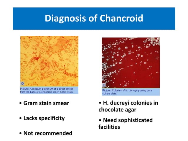 Genital ulcer syndro.pptx