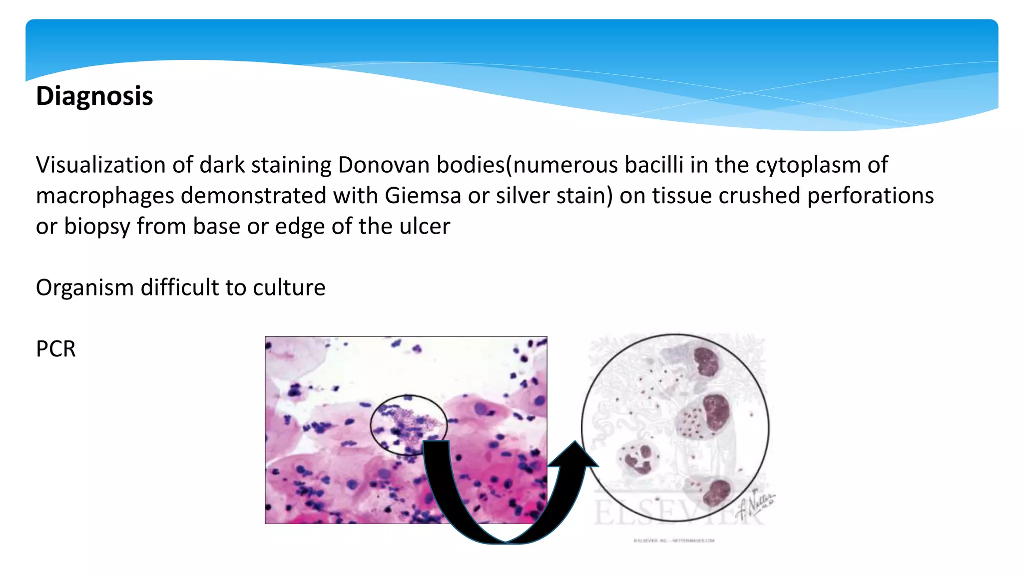 Genital ulcers | PPTX