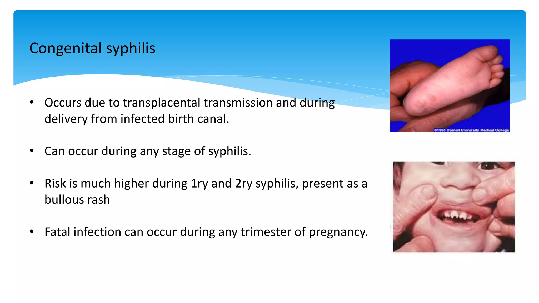 Genital ulcers | PPTX