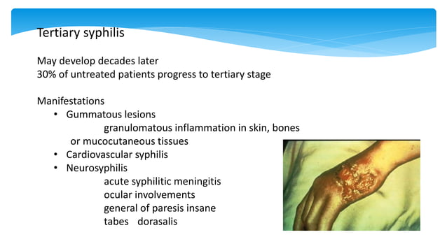 Genital ulcers | PPTX