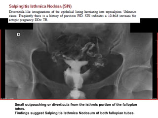 GENITO-GYNAEOBS (Compiled ).pptx