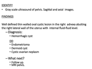 GENITO-GYNAEOBS (Compiled ).pptx