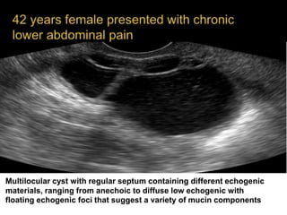 GENITO-GYNAEOBS (Compiled ).pptx