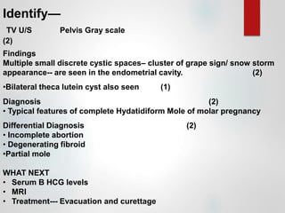 GENITO-GYNAEOBS (Compiled ).pptx