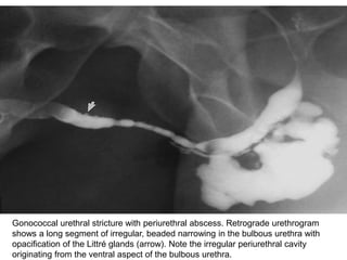 GENITO-GYNAEOBS (Compiled ).pptx