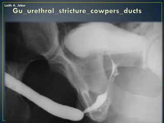Genito urinary diseases radiology | PPSX