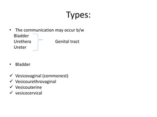 GENITO-URINARY FISTULA.pptx