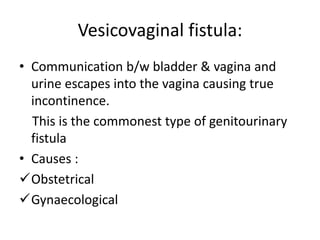 GENITO-URINARY FISTULA.pptx