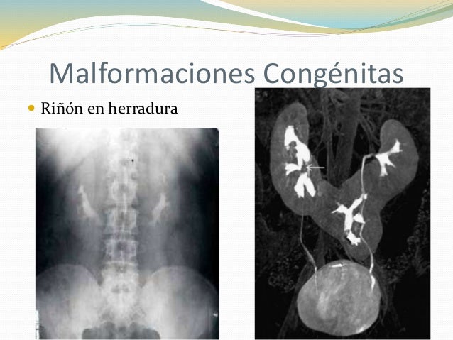 RADIOLOGIA GENITOURINARIA