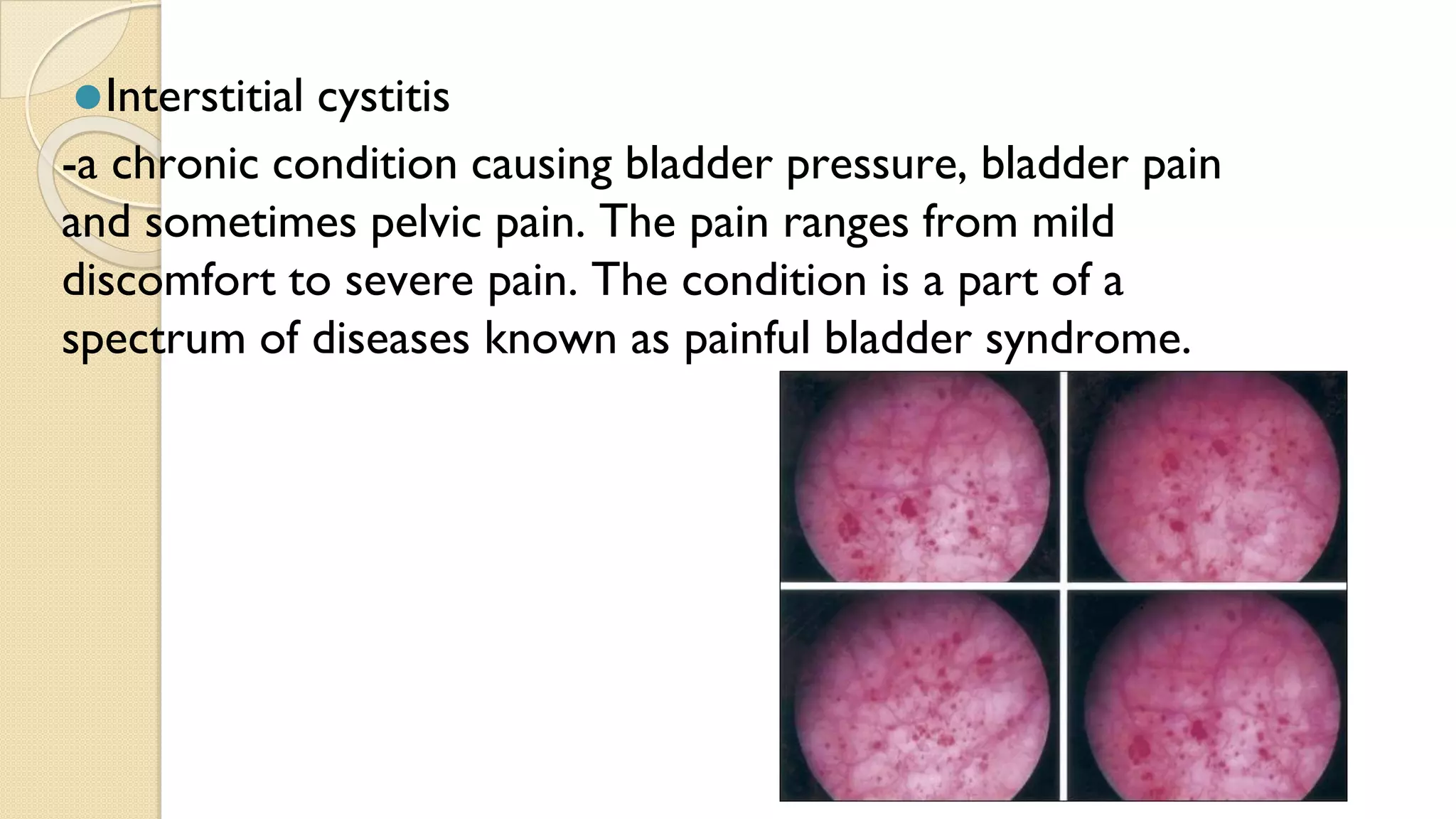 Genitourinary Assessment.pptx