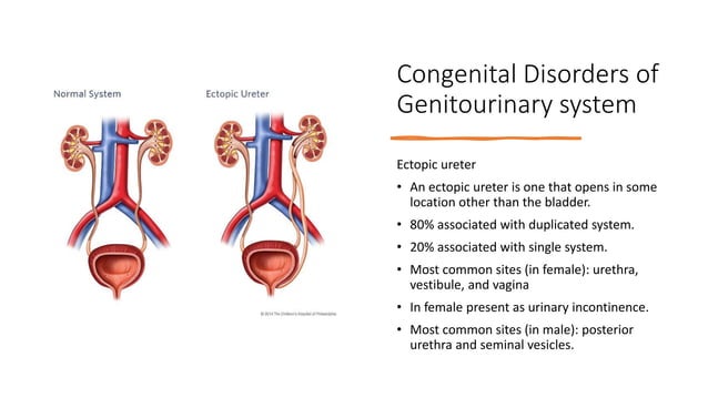 GENITO URINARY DISORDERS-2.pptx