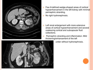 genitourinary infection radiology.pptx