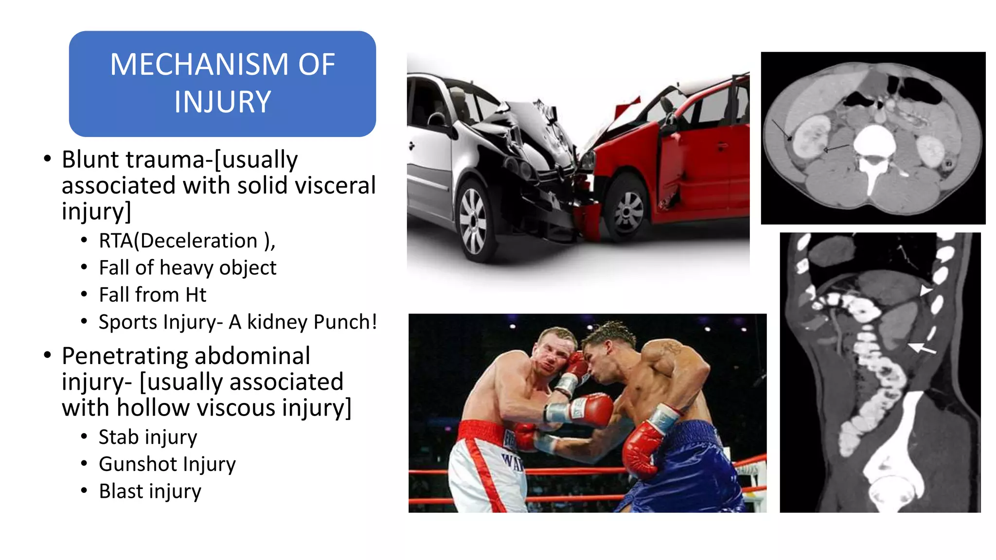 Trauma to Urinary Tract/ Urinary Tract Injury | PPTX