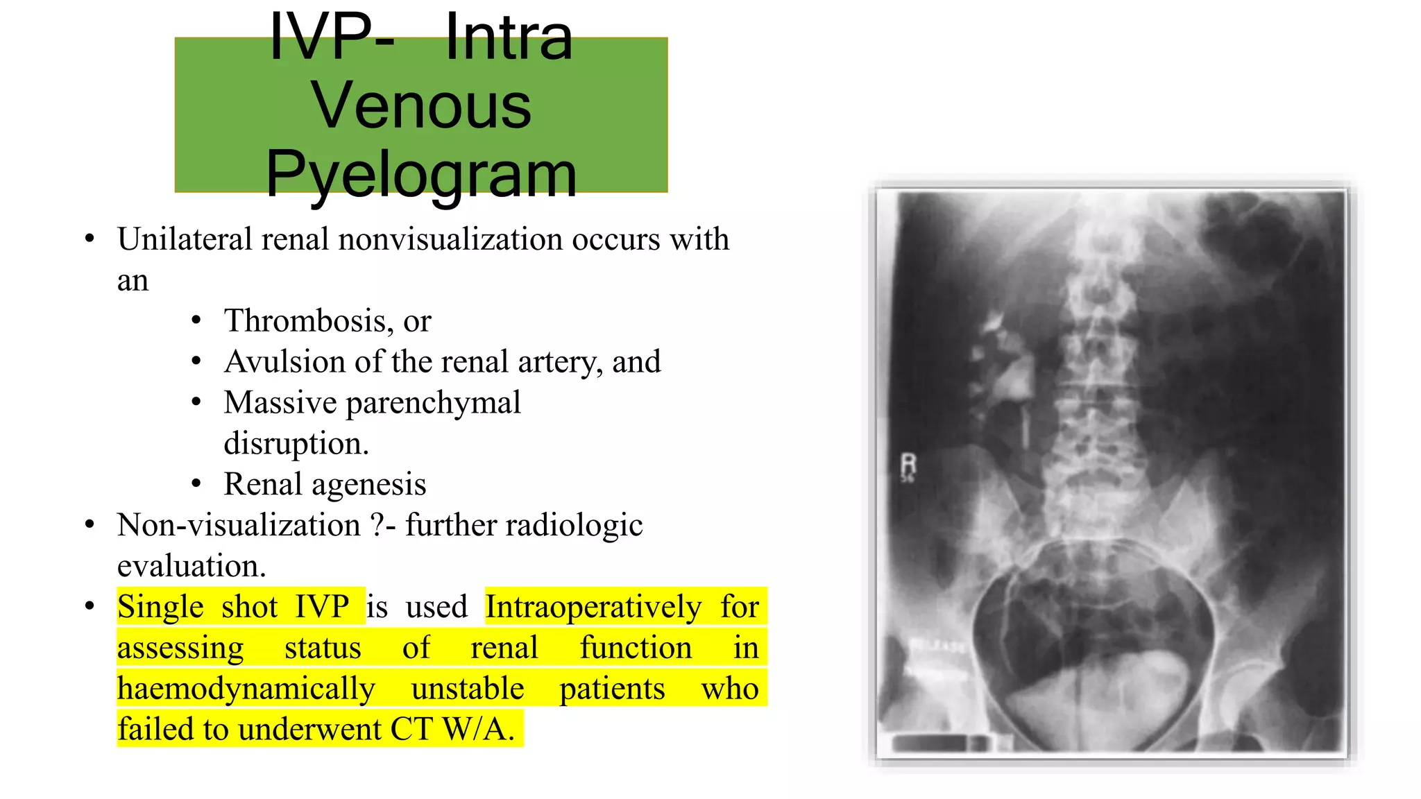 Trauma to Urinary Tract/ Urinary Tract Injury | PPTX