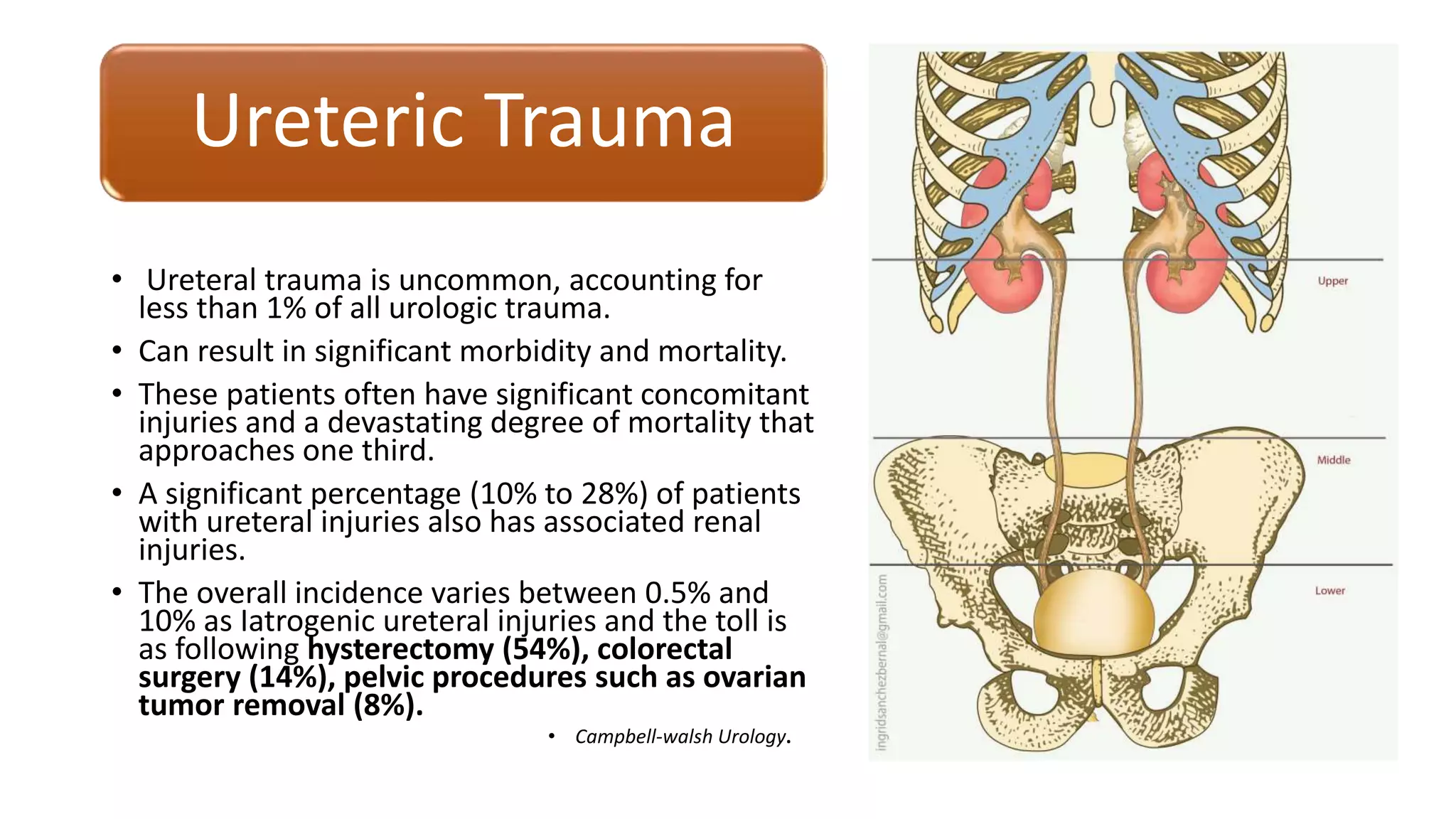 Trauma to Urinary Tract/ Urinary Tract Injury | PPTX