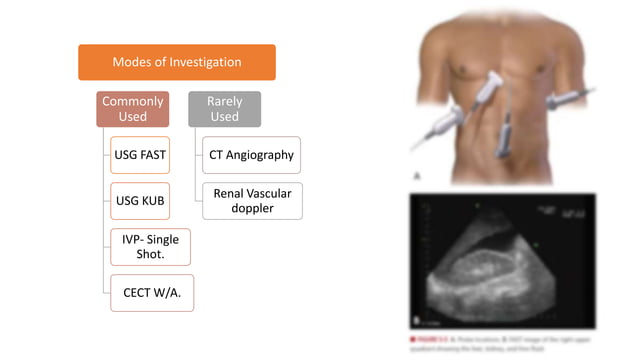 Trauma to Urinary Tract/ Urinary Tract Injury | PPT