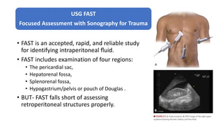 Trauma to Urinary Tract/ Urinary Tract Injury | PPTX