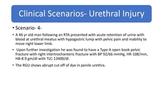 Trauma to Urinary Tract/ Urinary Tract Injury | PPTX
