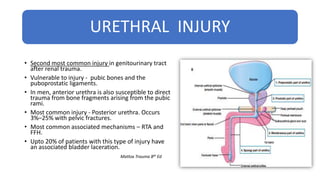 Trauma to Urinary Tract/ Urinary Tract Injury | PPTX