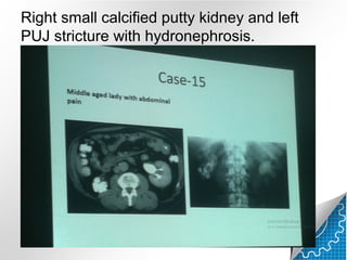 Genitourinary mocks radiology | PPT