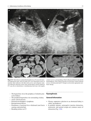 Genitourinary radiology kidney, bladder and urethra | PDF