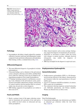 Genitourinary radiology kidney, bladder and urethra | PDF