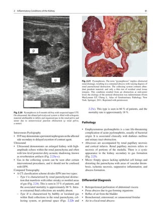 Genitourinary radiology kidney, bladder and urethra | PDF
