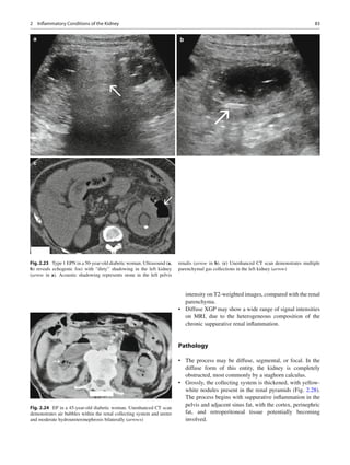 Genitourinary radiology kidney, bladder and urethra | PDF