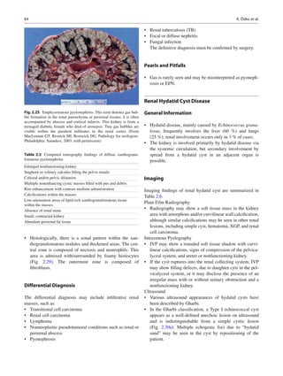Genitourinary radiology kidney, bladder and urethra | PDF