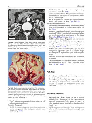 Genitourinary radiology kidney, bladder and urethra | PDF