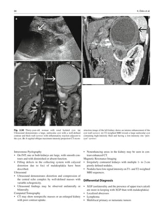 Genitourinary radiology kidney, bladder and urethra | PDF