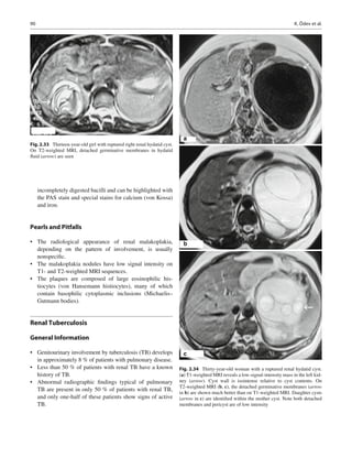 Genitourinary radiology kidney, bladder and urethra | PDF