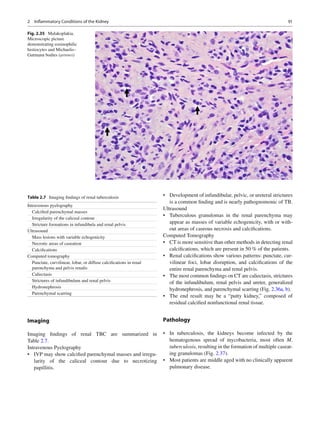 Genitourinary radiology kidney, bladder and urethra | PDF