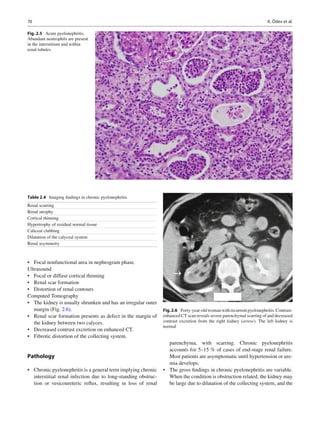 Genitourinary radiology kidney, bladder and urethra | PDF