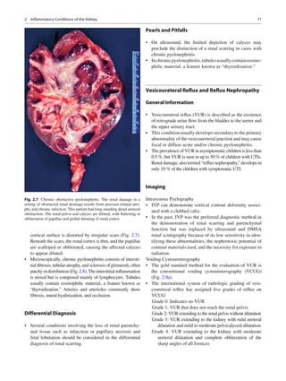 Genitourinary radiology kidney, bladder and urethra | PDF