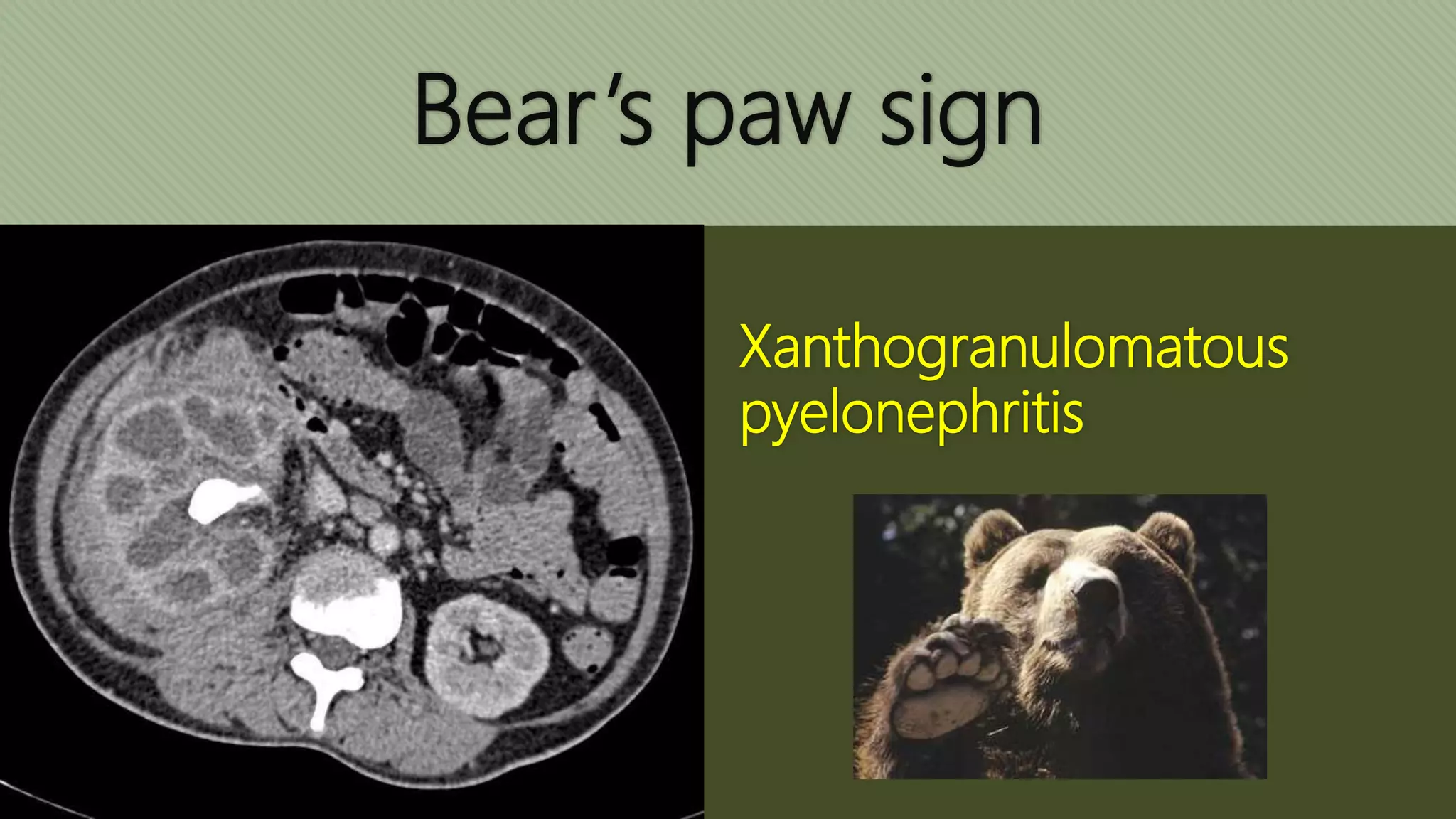 Genitourinary signs | PPT