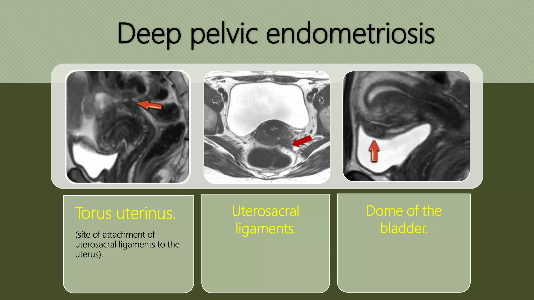 Genitourinary signs.pptx